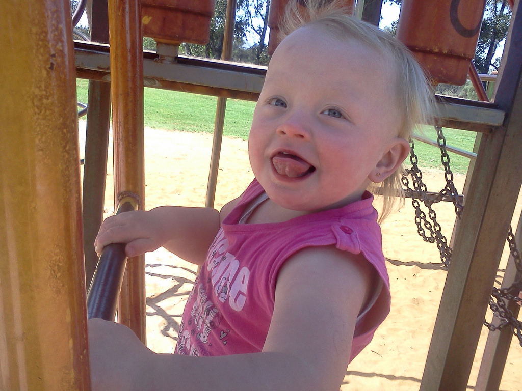 Trẻ tăng trưởng quá mức có thể đã mắc hội chứng Beckwith Wiedemann